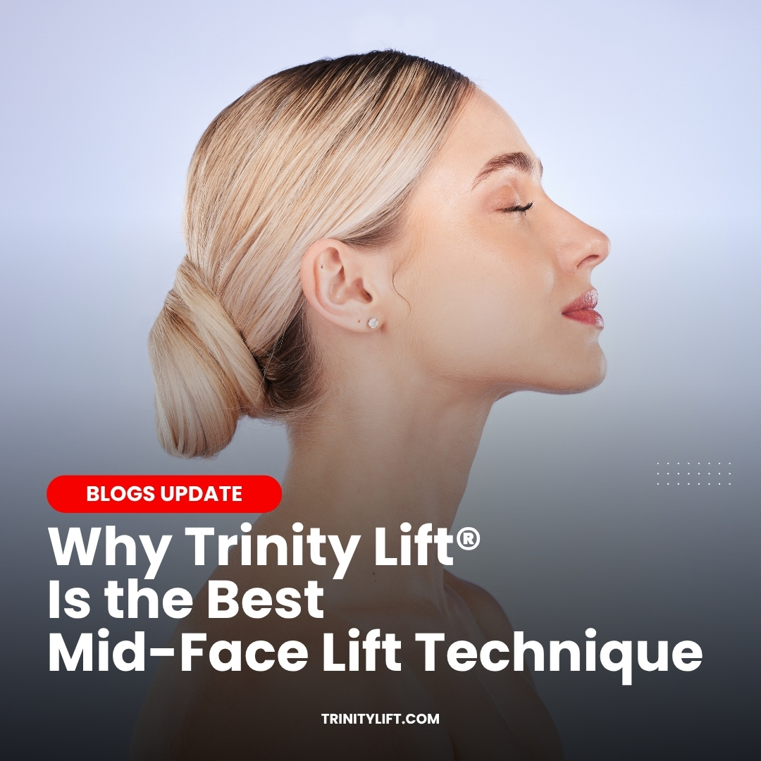 Trinity Lift detailed explanation - Trinity Lift